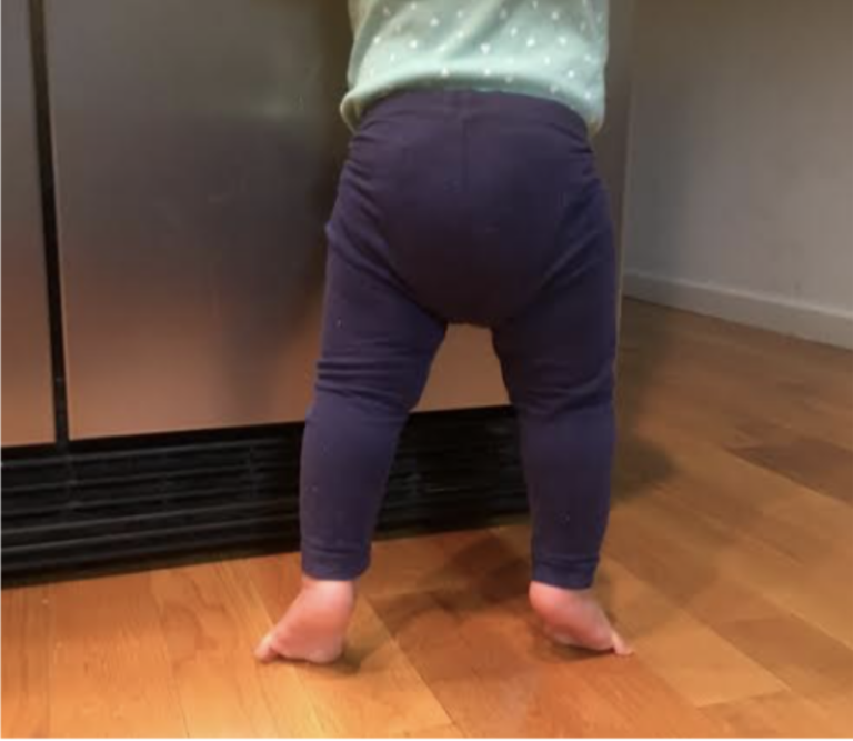 Toe Walking – Motor Skills Matter | Pediatric Physical Therapy NYC ...